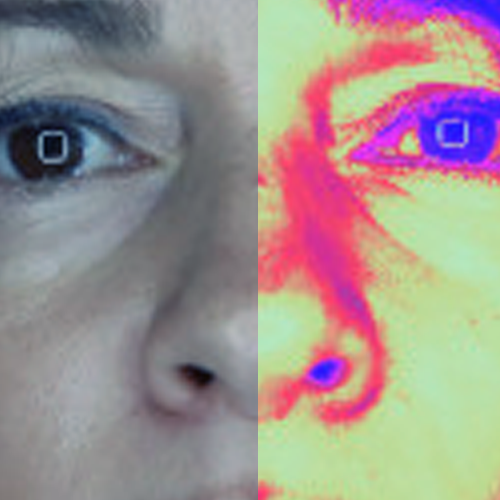 Skin Imaging Eotech