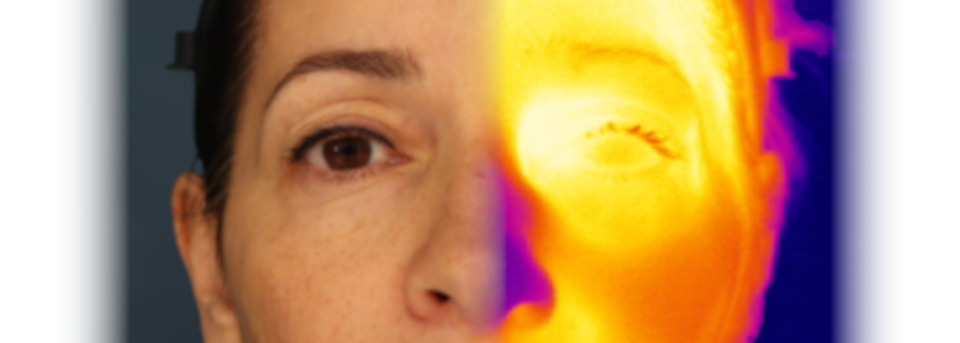 Skin imaging - EOTECH